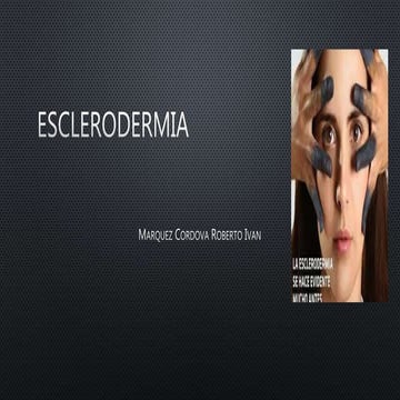 Esclerodermia | PPTX