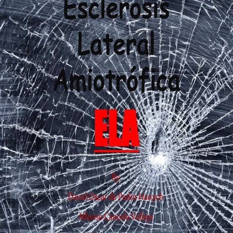 Esclerosis lateral amiotrófica | PPTX