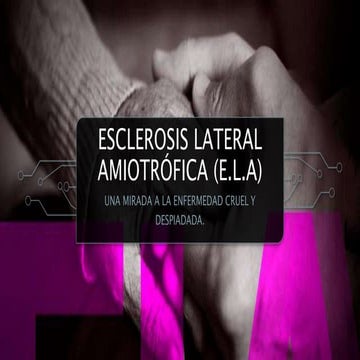 Esclerosis lateral amiotrófica | PPTX