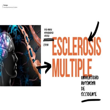 Esclerosis multiple | PPTX