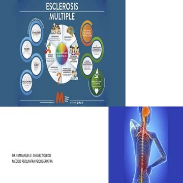 Esclerosis multiple, diagnóstico y pronóstico inmunoquímico | PPTX