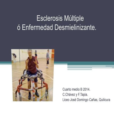 Esclerosis multiple | PPTX