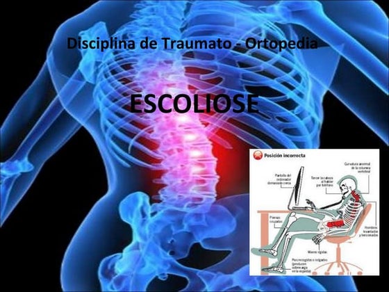 Tecnica radiografica | PPT