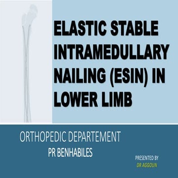 ESIN LOWER LIMB FEMUR AND TIBIA FRACTURES .pptx