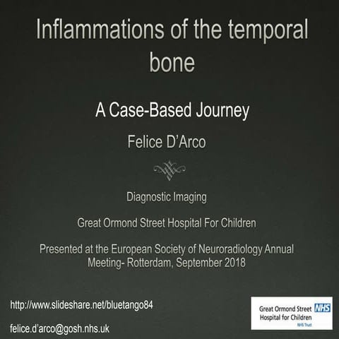 inflammations of the Temporal Bone: Imaging and differential diagnosis ...