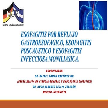 ESOFAGITIS POR REFLUJO GASTROESOFAGICO, ESOFAGITIS POSCAUSTICO Y.pptx
