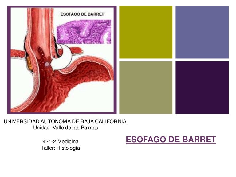 Esofago de Barrett