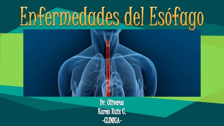 Enfermedades de Esófago Clínica