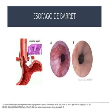 Semiología de los Puntos dolorosos | PPTX