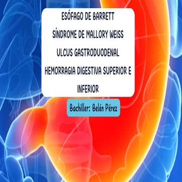 Esofago_de_Barrett,_sindrome_de_Mallory_Weiss,_ulcus_gastroduodenal.pdf