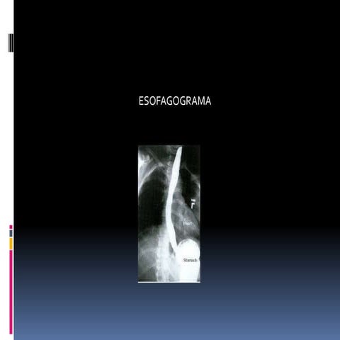 EED - Seriografia do Esôfago Estomago e Duodeno | PPTX