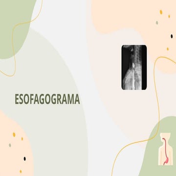 Esofragograma con contraste de bario.pptx