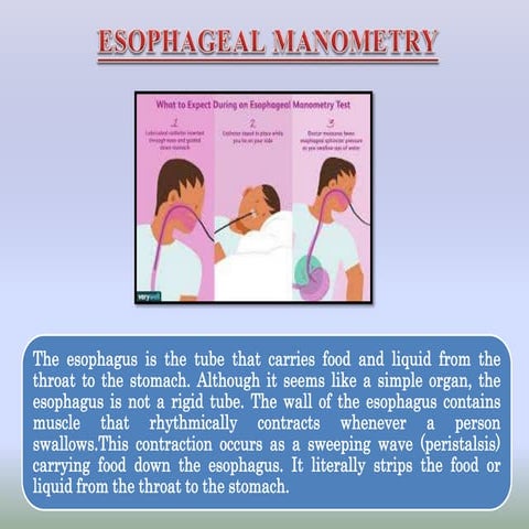 Esophageal manometry | PPTX