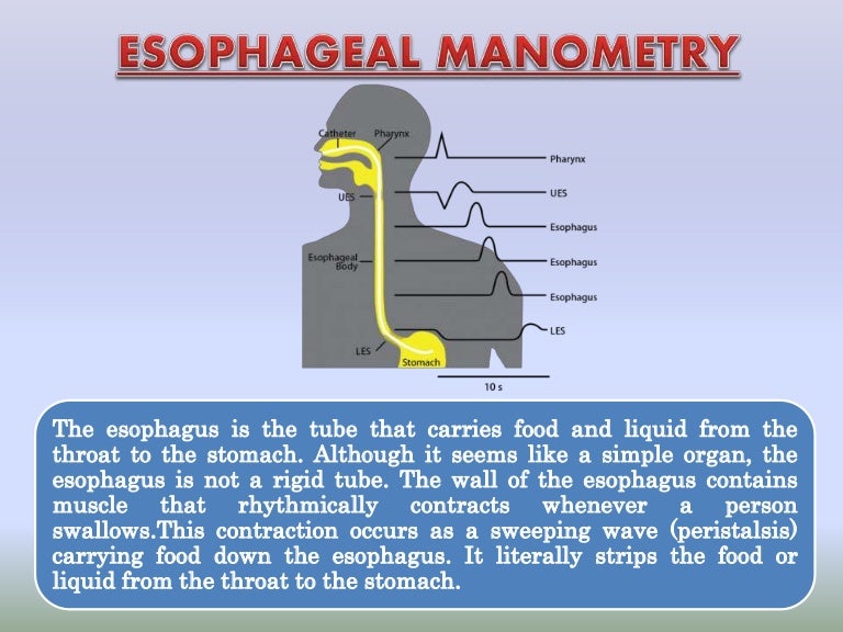 Esophageal manometry