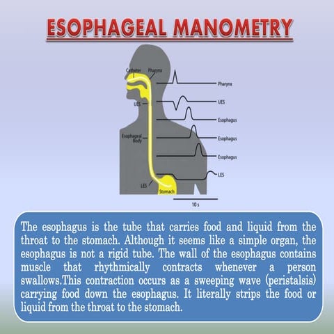 Esophageal manometry | PPTX