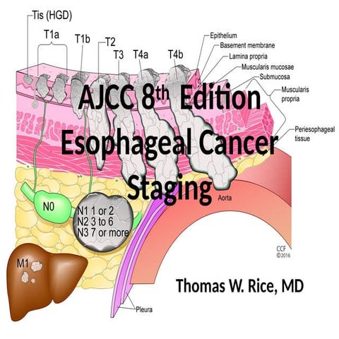 esophagus-8th-ed.pptx RAD ONCO ; ESOPHAGUS | PPTX