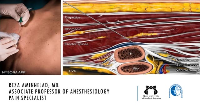 Pec I and PECS II, serratus anterior block | PPTX