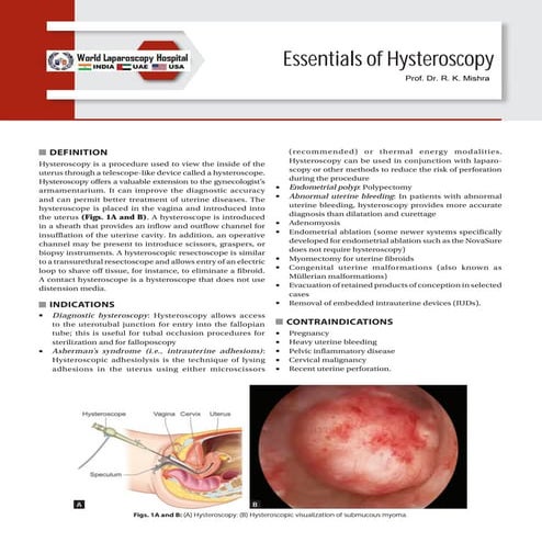 Essentials of Hysteroscopy at World Laparoscopy Hospital | PDF