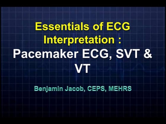 ECG interpretation: the basics | PPT