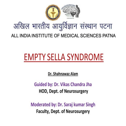 Empty sella syndrome | PPTX