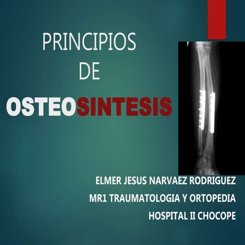 Tipos de Materiales de Osteosintesis y su Empleo.pptx