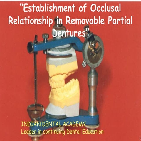 Establishment of occlusal relationship in rpd/endodontic courses | PPT