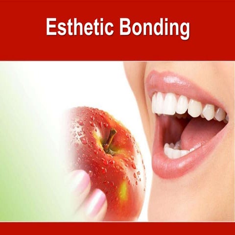 Esthetic Bonding | PPTX