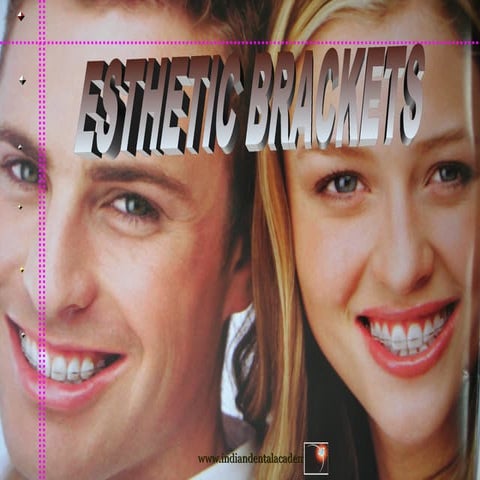 Esthetic brackets/ dental implant courses | PPT