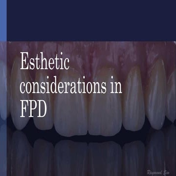 esthetic considerations in fixed partial dentures.pptx