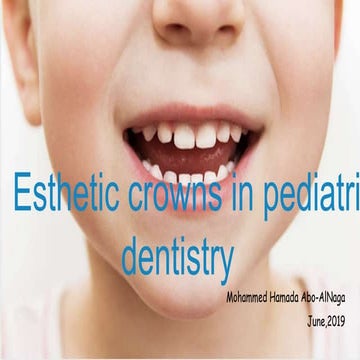 Esthetic crowns used in pediatric dentistry | PPTX