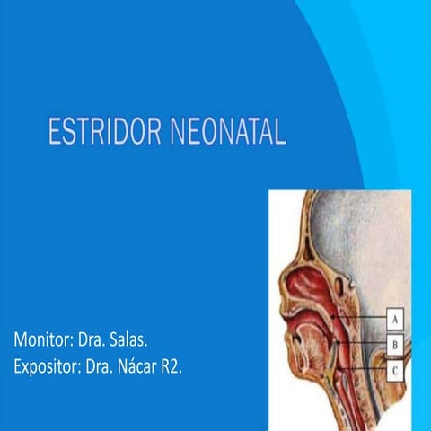 Estridor.pptx.Neonatal laríngeo en pediatría | PPTX