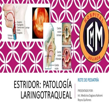 estridor patologia laringotraqueal .pptx