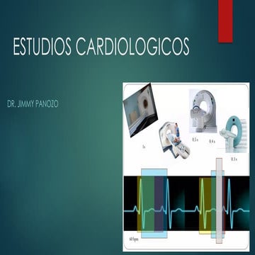 ESTUDIOS CARDIOLOGICOS.pptx de cardiologia | PPTX