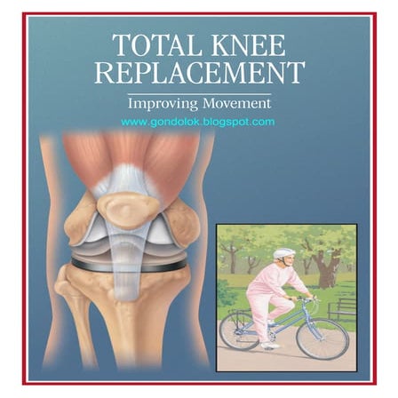 Total knee replacement nursing management | PPTX