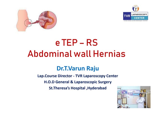 EXTENDED TOTALLY EXTRA-PERITONEAL REPAIR {eTEP} | PPTX
