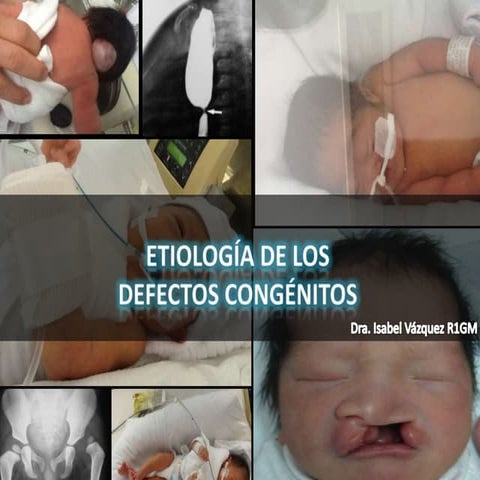 Etiología de los defectos congénitos | PPTX