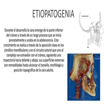 Maloclusión clase 3 dental y esqueletal en ortodoncia. | PPTX