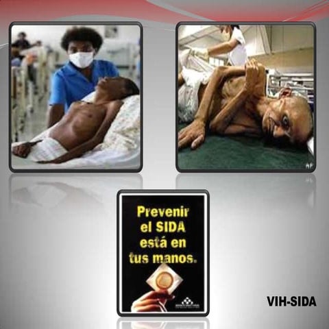 Cartelera ETS | PPTX | Sexual Conditions | Sexual Health