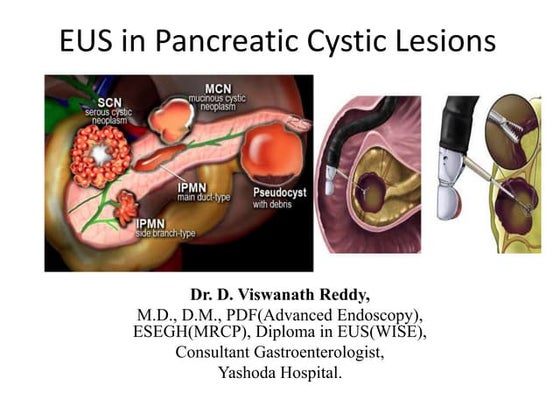Presentation%20(1).pptx percutaneous omental biopsy | PPT