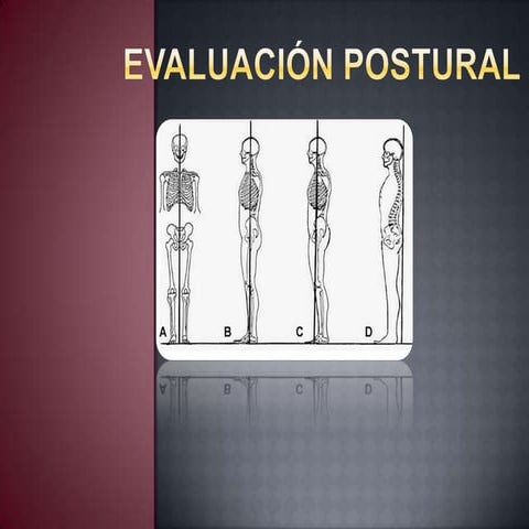 Evaluación postural | PPTX