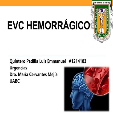 EVC hemorrágico | PPT