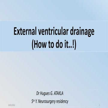 External Ventricular Drain | PPT