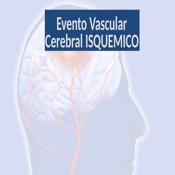 Evento vascular cerebral isquemico | PPTX