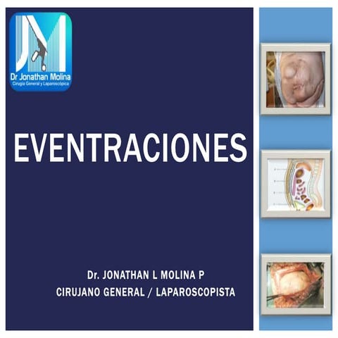Escala forrest hemorragia digestiva | PDF