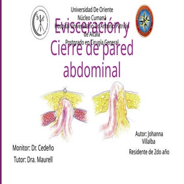 Evisceracion, definicion, clasificacion, tratamiento | PPTX