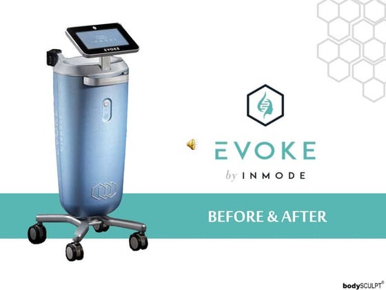 EVOLVE by InMode – Before & After | PPT
