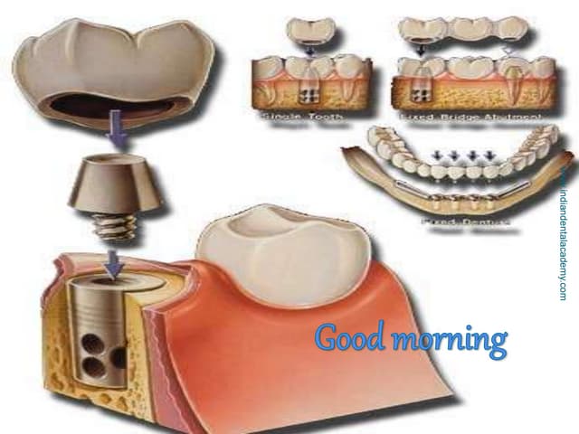 Vertical- Machining - Center - VMC -LMW-Machine-Tool-Division.pptx