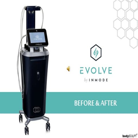 EVOLVE by InMode – Before & After | PPSX