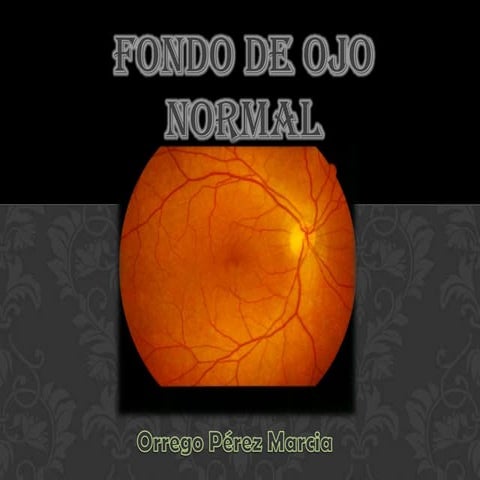 Examen de fondo de ojo | PPTX