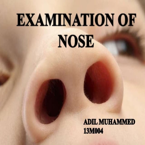 Examination of nose.pptx